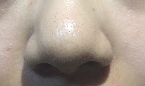 %e9%bc%bb%e5%ad%90%e6%ad%a3%e9%9d%a2 – momo好物開箱部落格